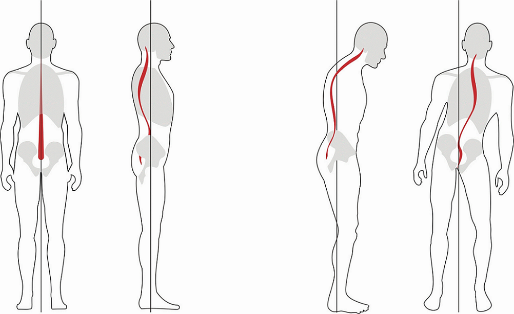 normal-posture-resized | Perfect Form Physiotherapy